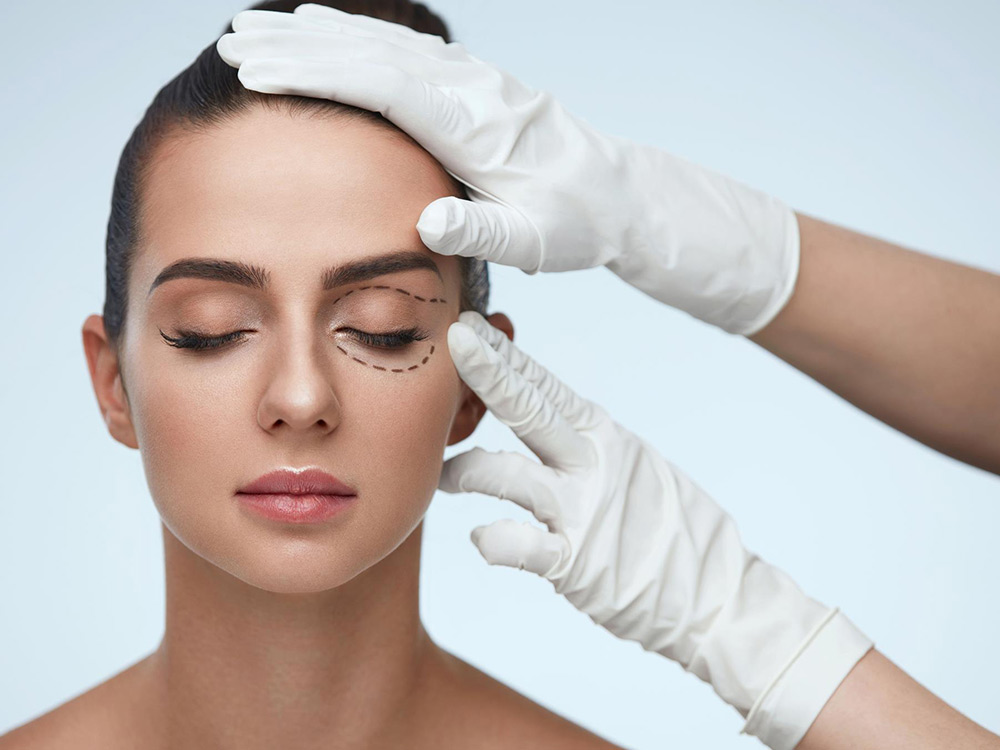 Los Beneficios que aporta la Blefaroplastia - Nelly Cartró